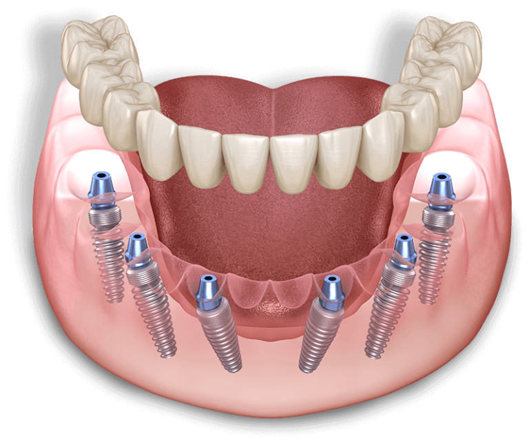 Home - Star Dental