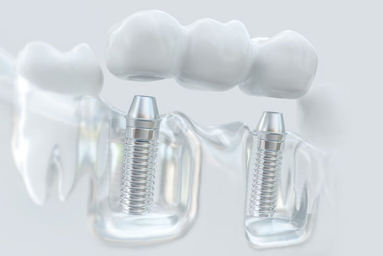 Home - Star Dental