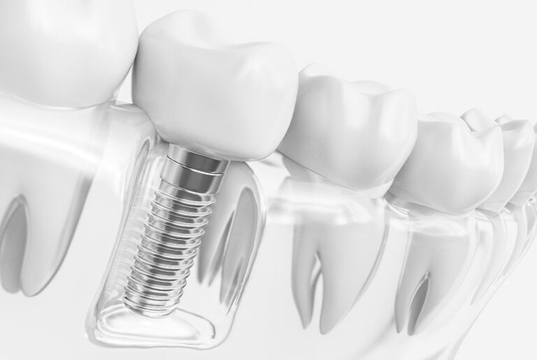 Home - Star Dental